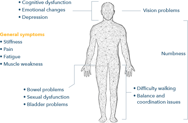 How is MS diagnosed? | MSConnections